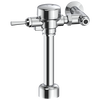 Manual Exposed Water Closet Flush Valve in Chrome 81T201 | Delta Faucet